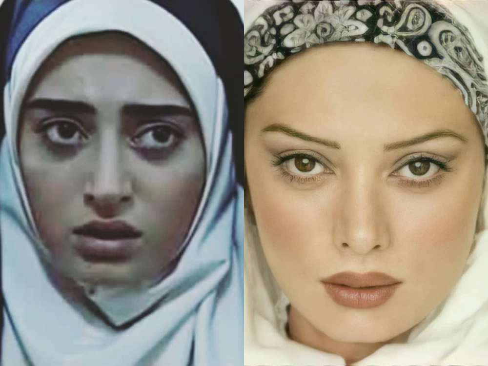 نگار فروزنده قبل از لیفت و جراحی های زیبایی شدید را میشناسید