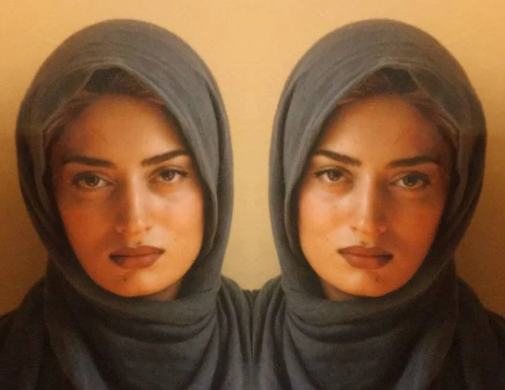 نگار فروزنده قبل از لیفت و جراحی های زیبایی شدید را میشناسید