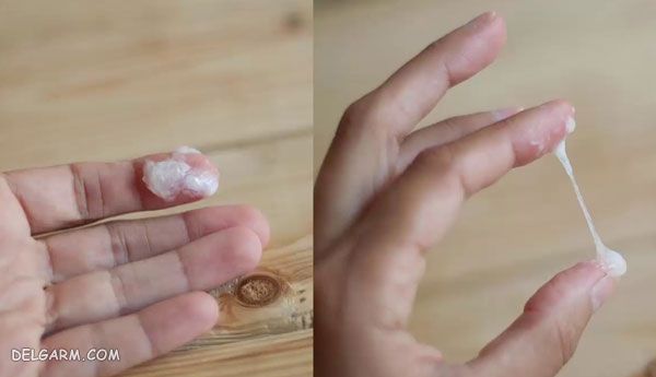 آشنایی با موثرترین راهکارهای خانگی برای درمان ترشحات واژن